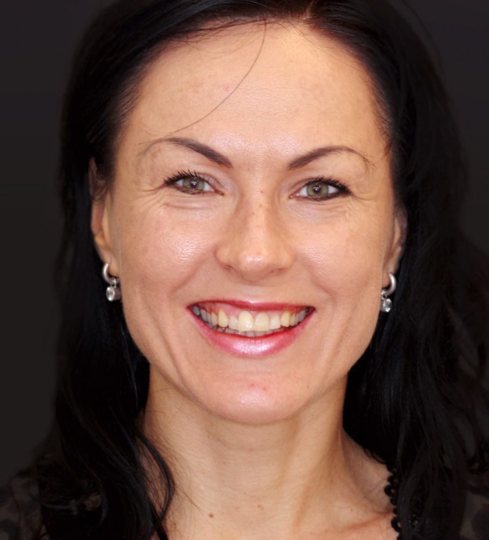 Treatment results - Ordoline