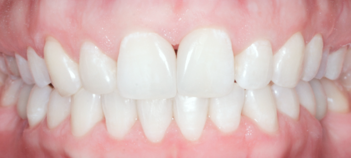 Treatment results - Ordoline