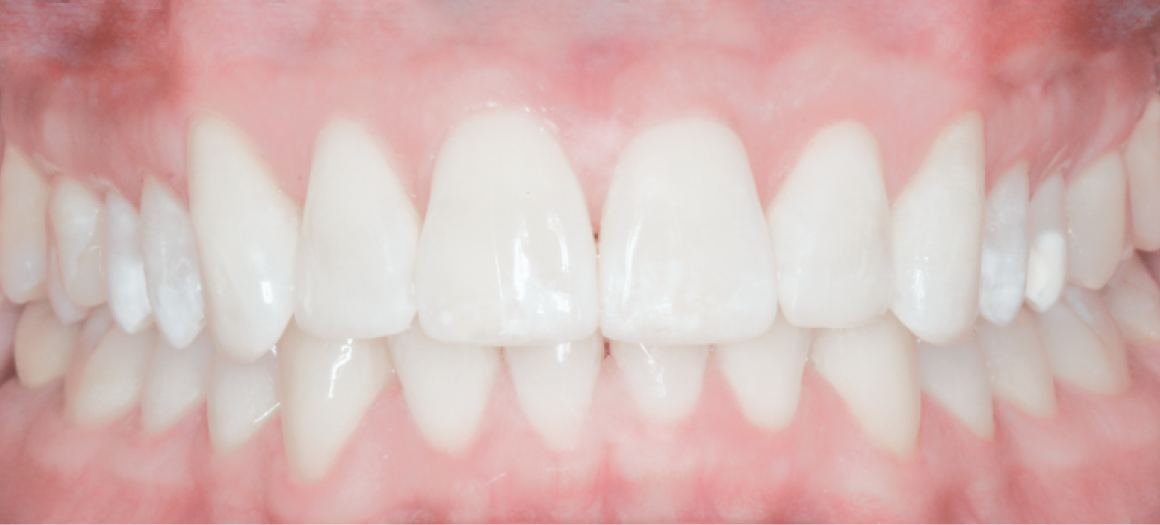 Treatment results - Ordoline