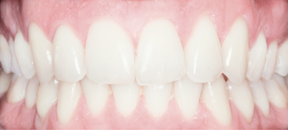 Treatment results - Ordoline