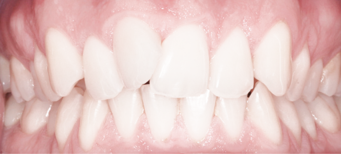 Treatment results - Ordoline